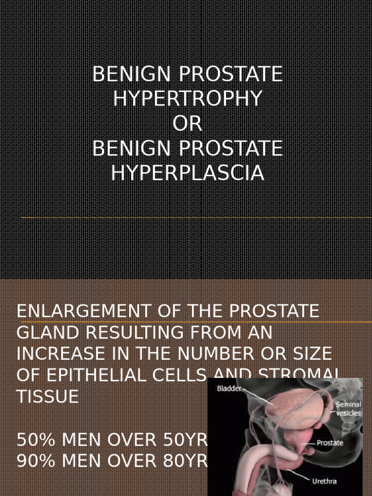 Benign Prostate Hypertrophy | PDF | Prostate | Urinary Incontinence
