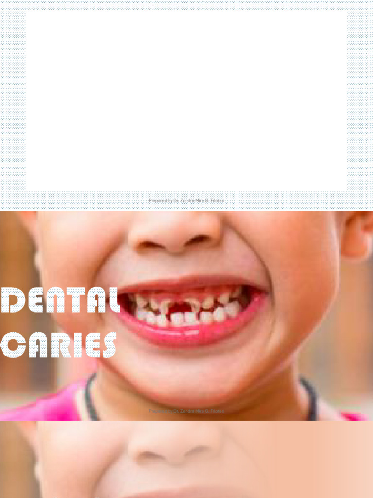Etiologic Basis of Dental Caries | PDF