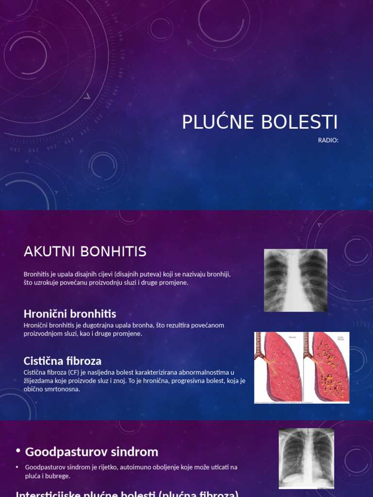 Plućne Bolesti | PDF