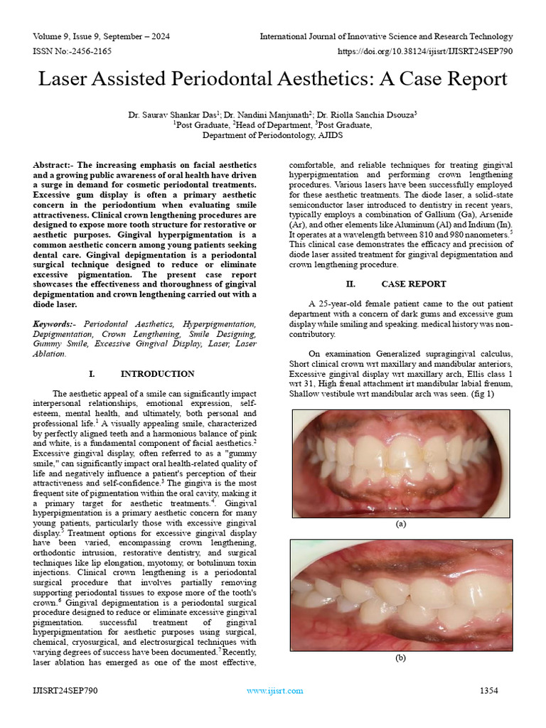 Laser Assisted Periodontal Aesthetics: A Case Report | PDF ...