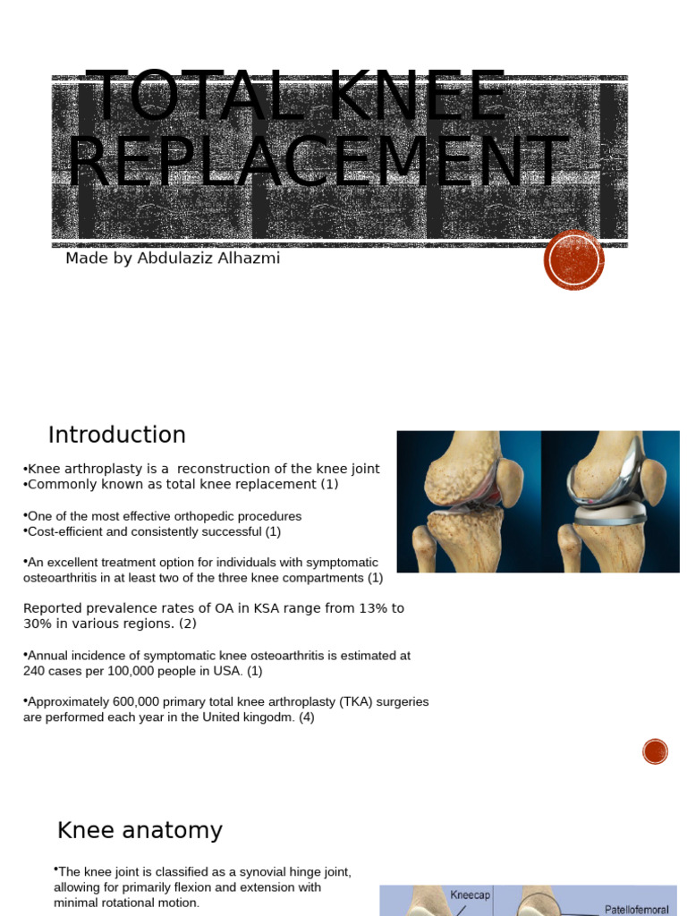 TKR Presentation by Abdualaziz Intern | PDF