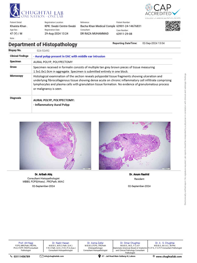 Department of Histopathology: - Aural Polyp Present in EAC With Middle ...