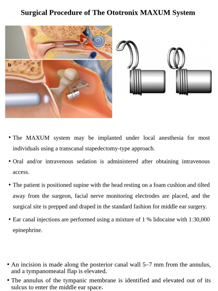 Surgical Procedure For MEI | PDF | Surgery | Ear