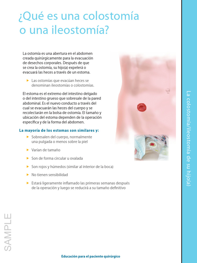 2022 Pediatric Colostomy SP Booklet Your Ostomy | PDF