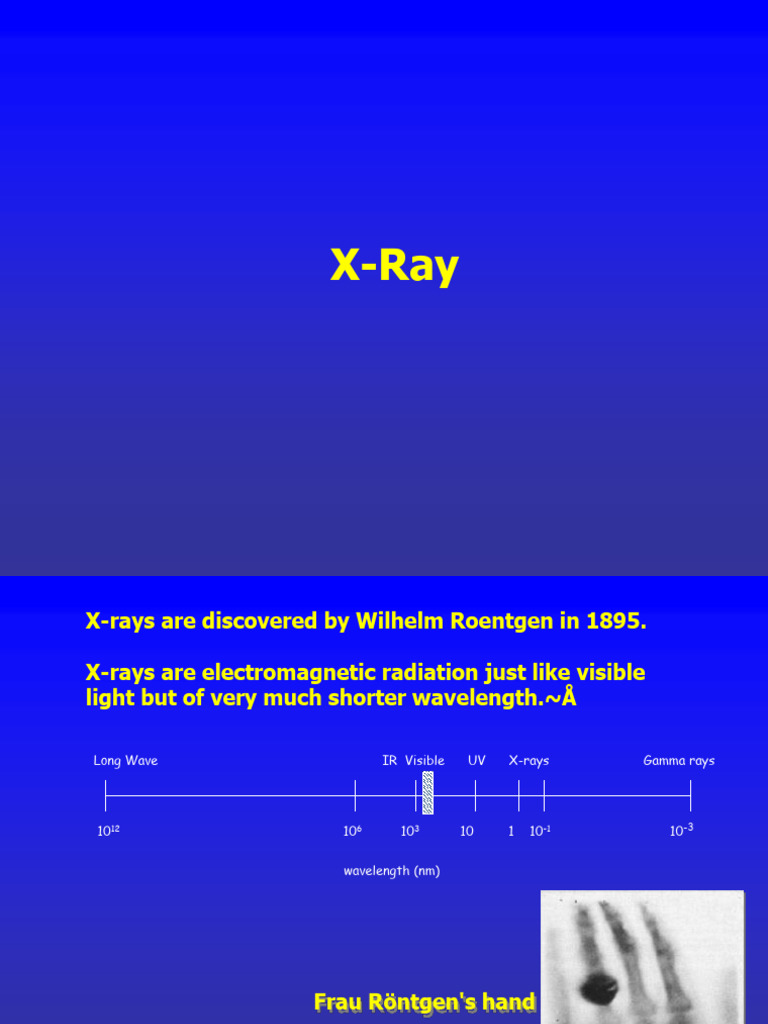 X-RAYS,, A Complete Course Stuy Guide For Presentation - All About X-Rays | PDF | X Ray ...