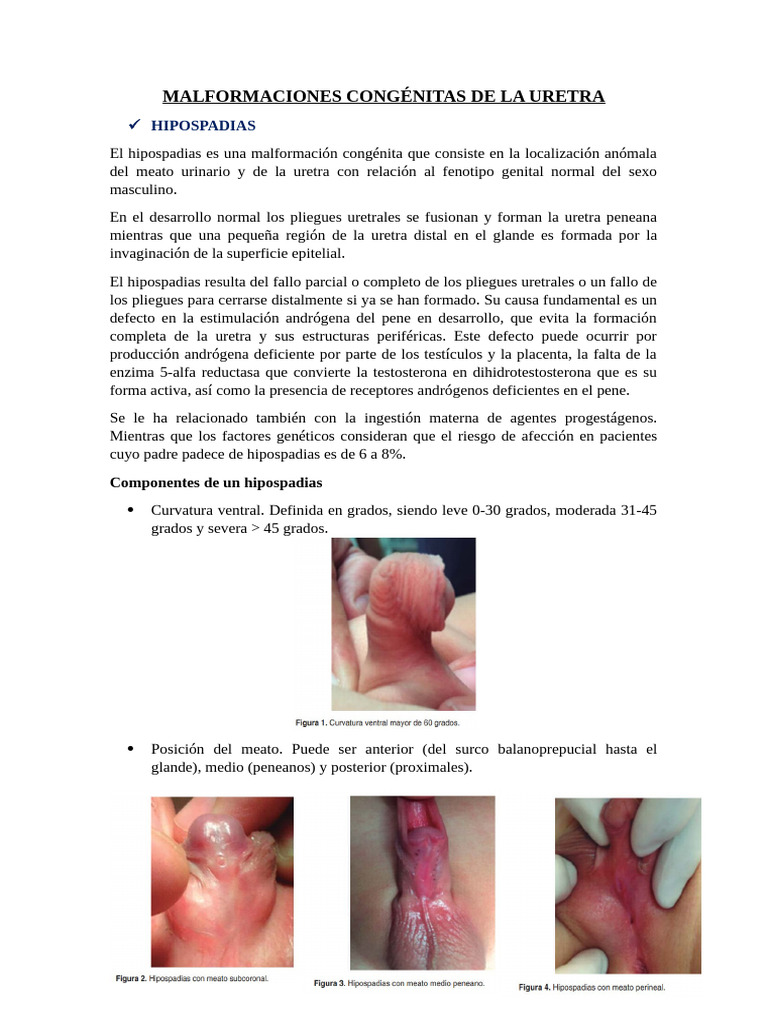 3 y 5. MALFORMACIONES DE URETRA y TESTÍCULOS | PDF | Especialidades ...
