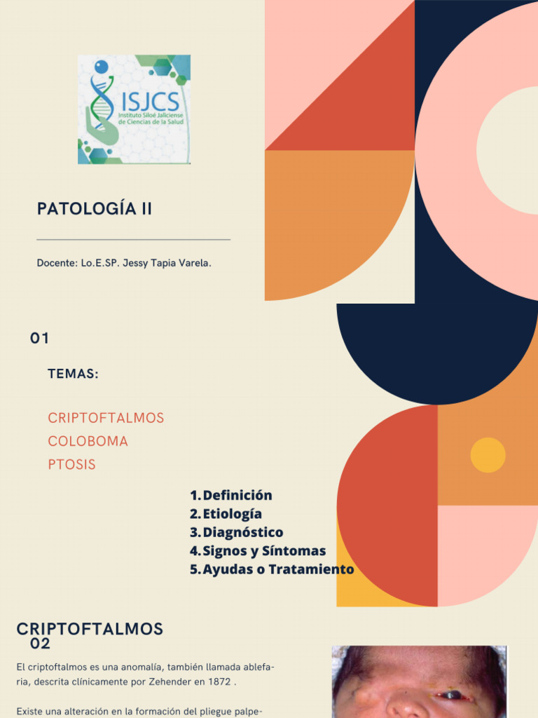 Criptoftalmos, Coloboma, Ptosis | PDF