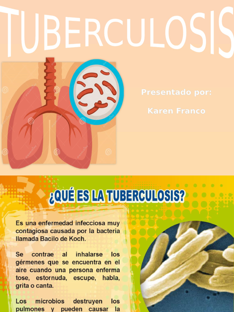 Tuberculosis | PDF