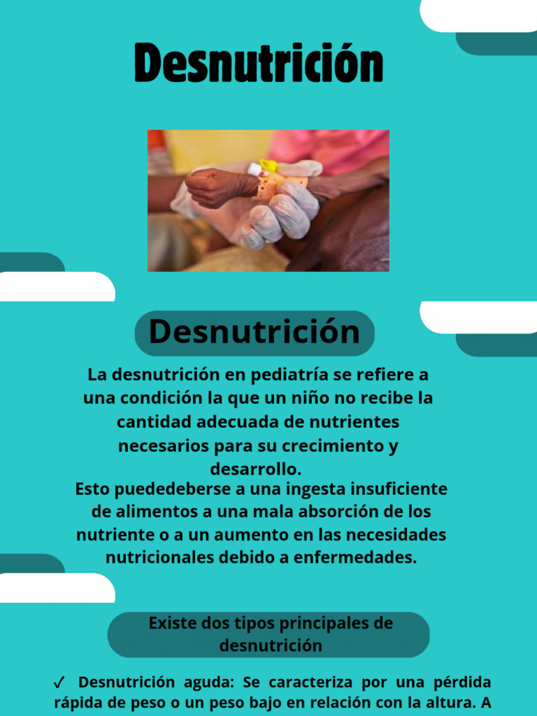 Desnutricion En Pediatria Pdf Pdf 20240915 184255 0000 Pdf