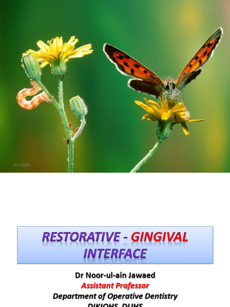 Restorative - Gingival Interface Modified | PDF