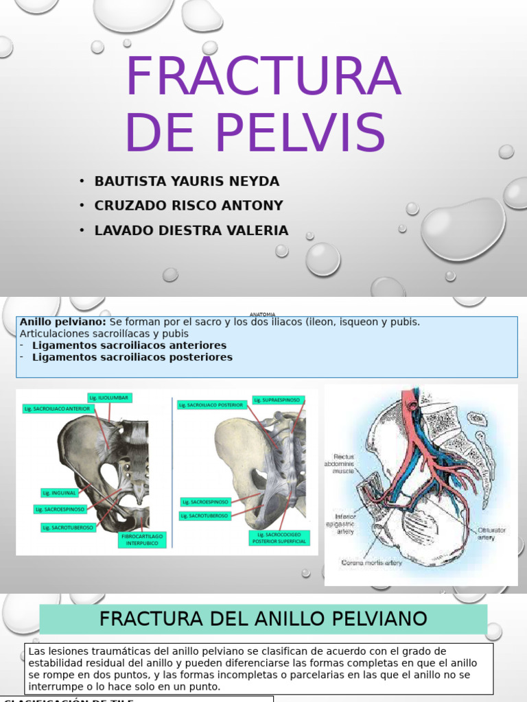Fractura De Pelvis Exposicion Pdf