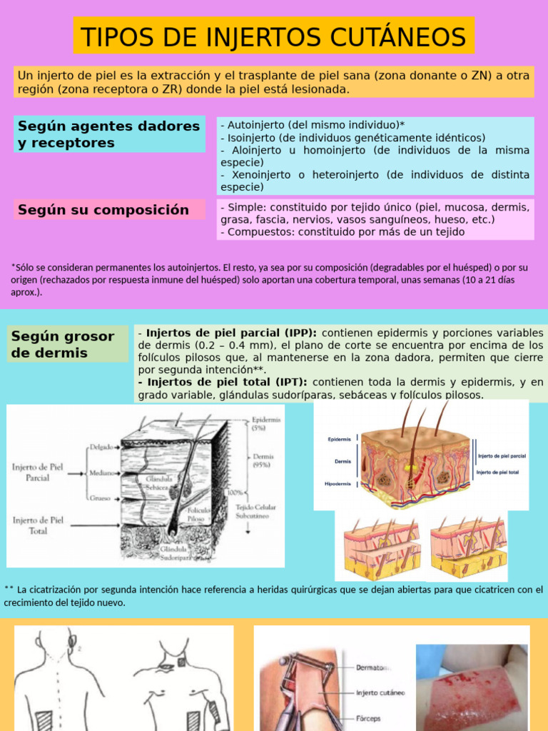 Tipos de Injertos Cutáneos | PDF