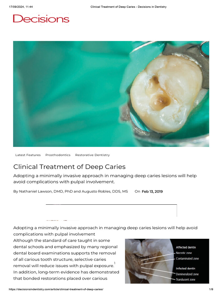 Clinical Treatment of Deep Caries - Decisions in Dentistry | PDF