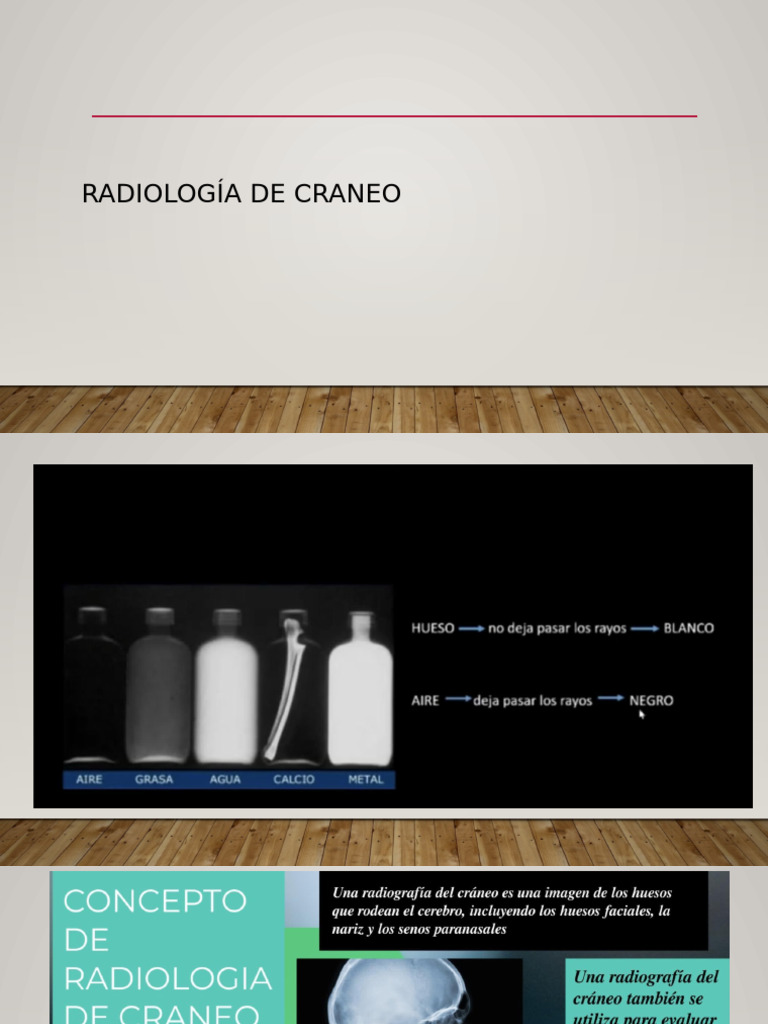 Radiología de Craneo 2 | PDF