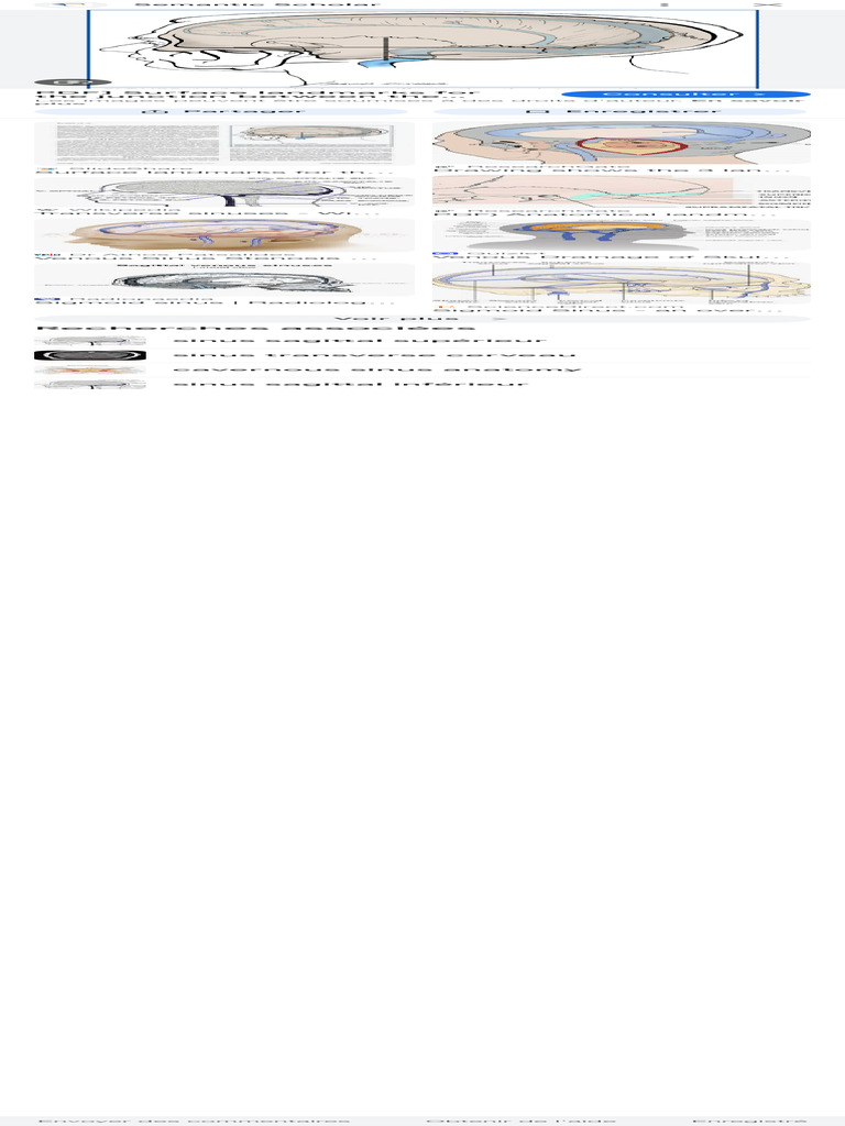 Cranial Landmarks Sinus - Recherche Google | PDF