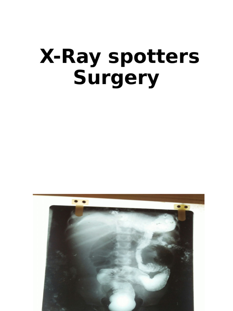 Surgery X-Ray - Spotters | PDF