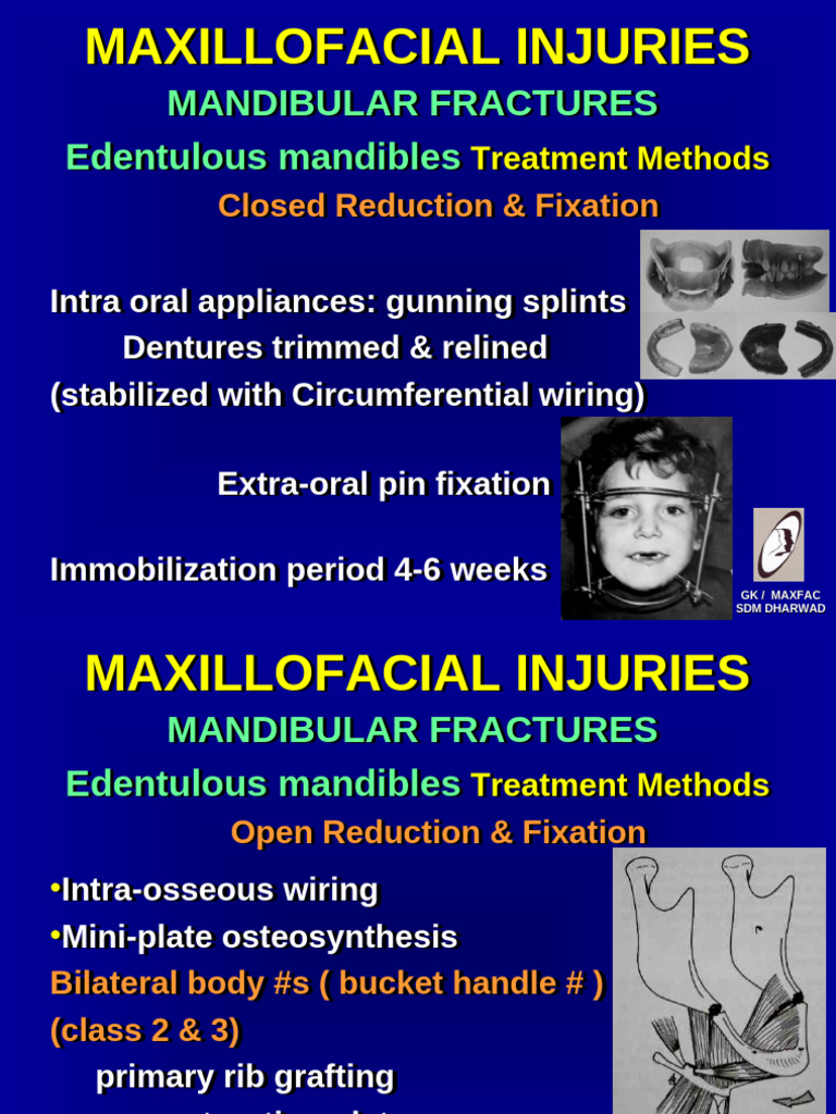 # Mandible (Cont) Condyle# | PDF