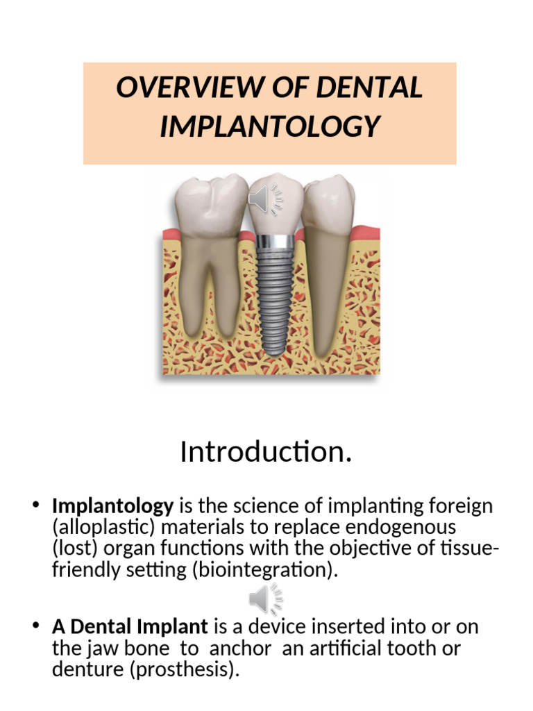 5 Implantology | PDF