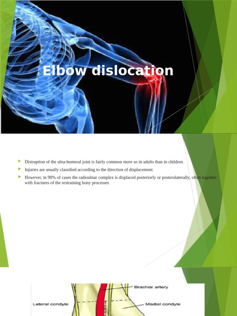 Elbow Dislocation | PDF