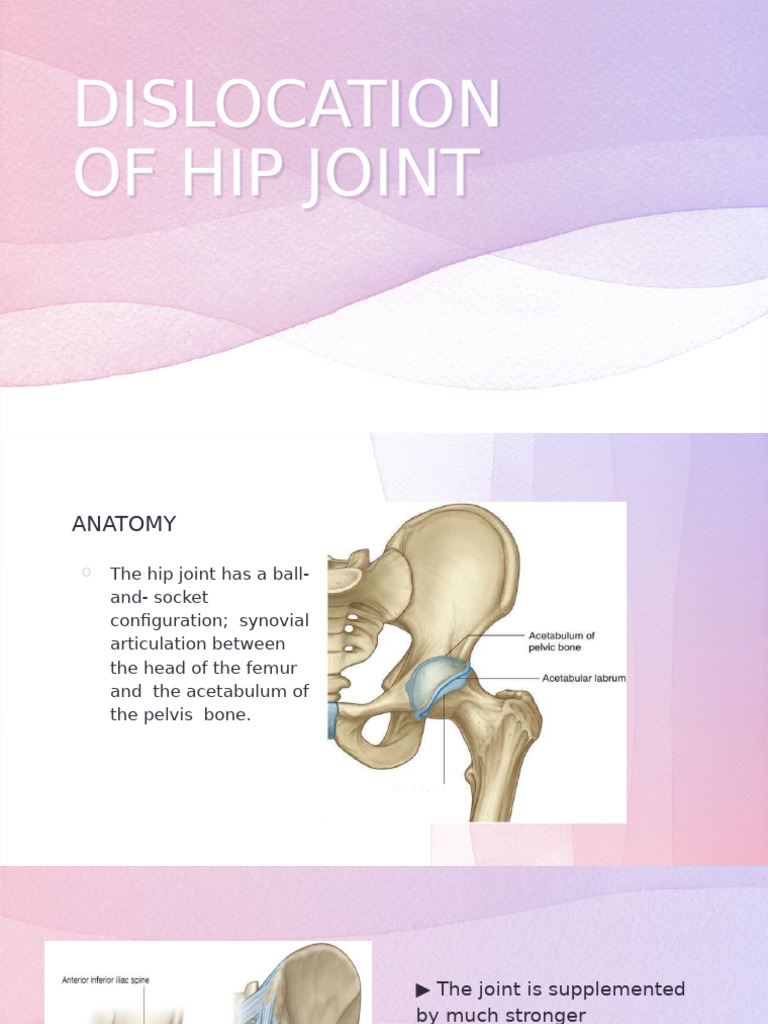Hip Dislocation | PDF