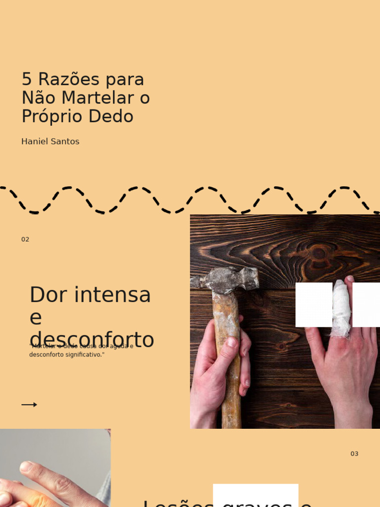 5 Razões para Não Martelar o Próprio Dedo | PDF