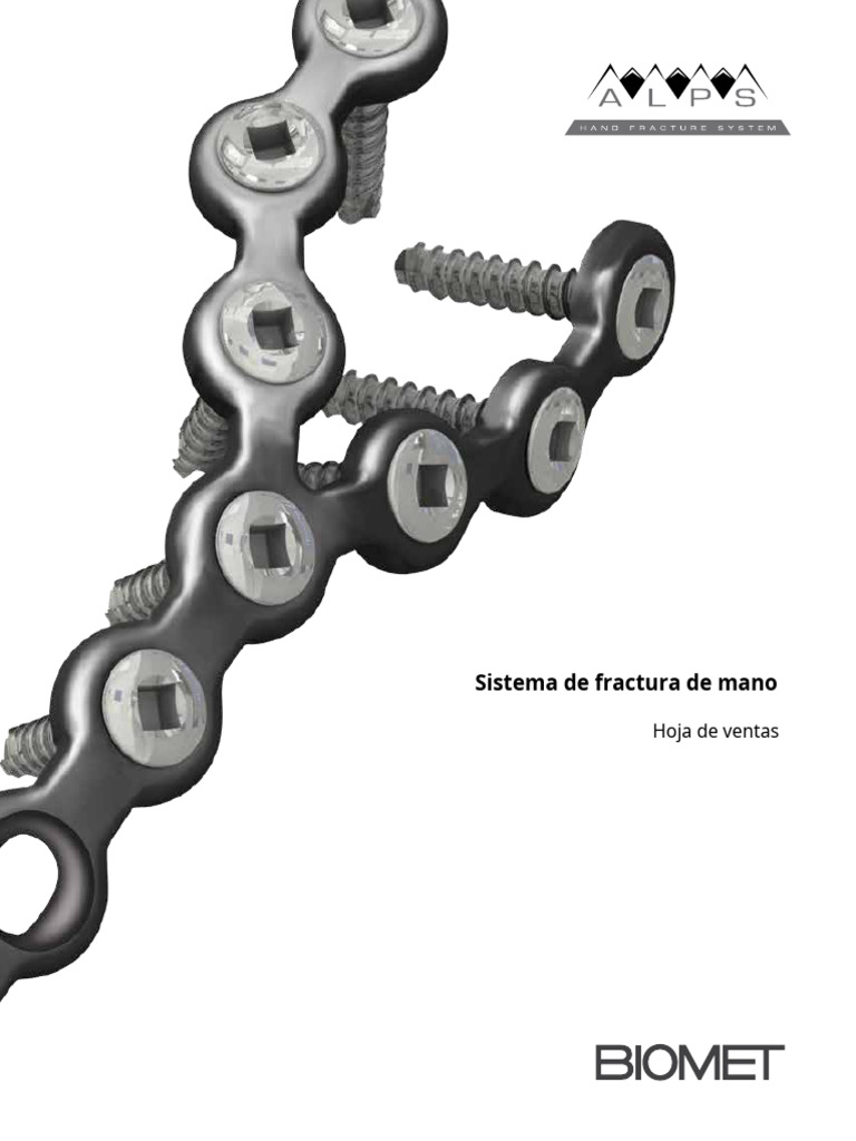 Alps-Hand-Fracture-System-Sales-Sheet - en - .Es - (MANO) | PDF