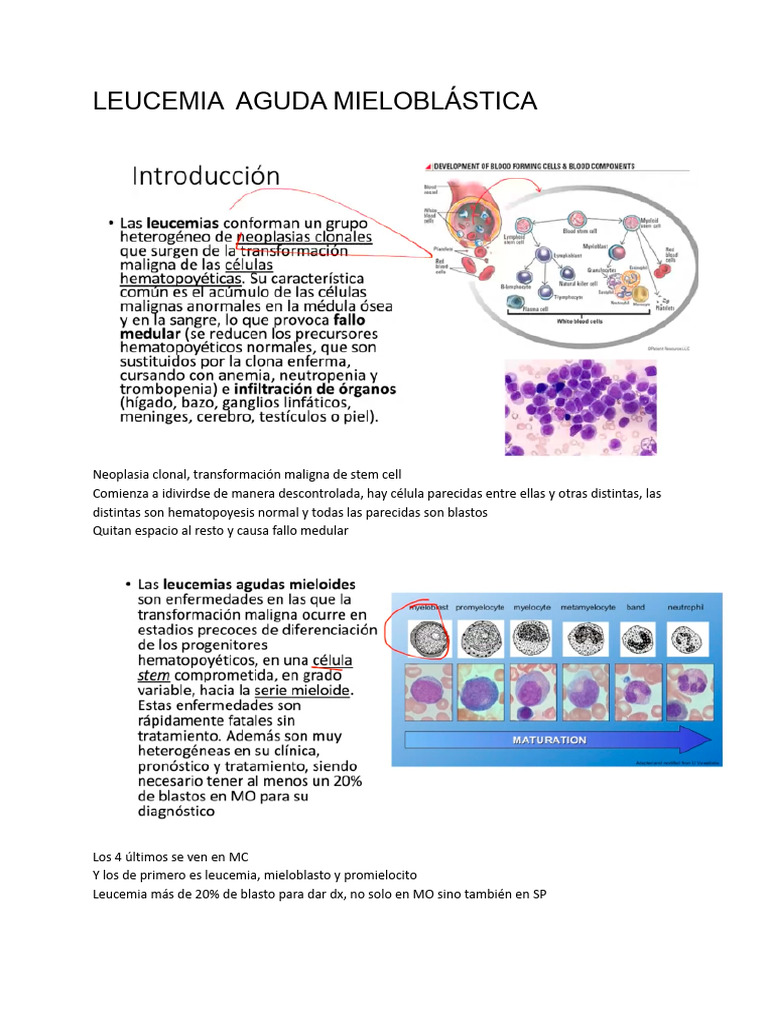 Leucemia Mieloblástica Aguda: Diagnóstico y Tratamiento | PDF ...