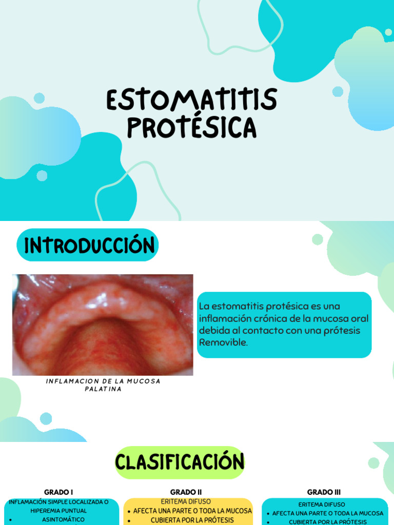 Estomatitis Protésica | PDF