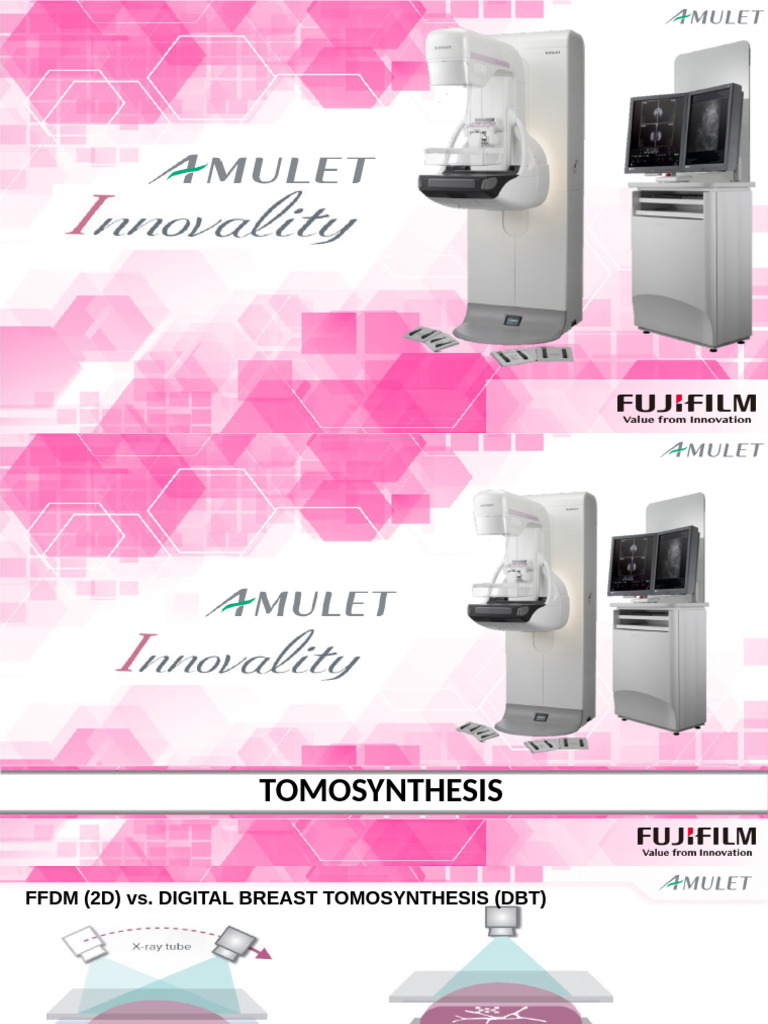 Digital Breast Tomosynthesis Overview | PDF