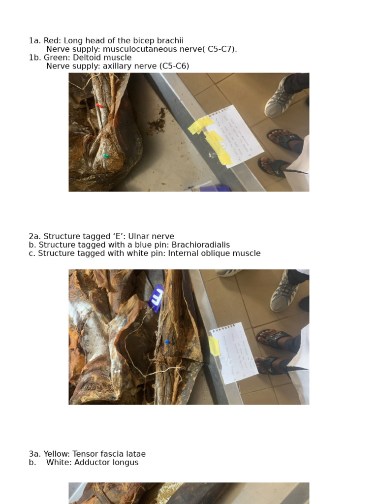 Gross Anatomy Mock Steeplechase | PDF