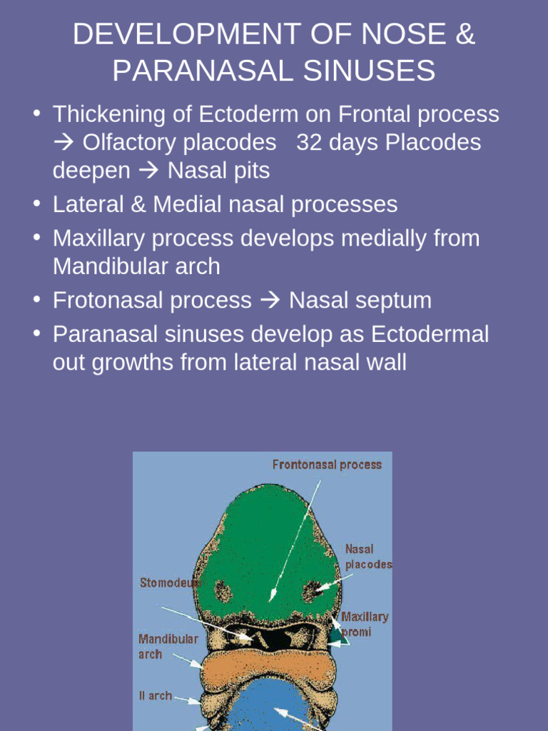 Congenital Anomalies of Nose 1 | PDF