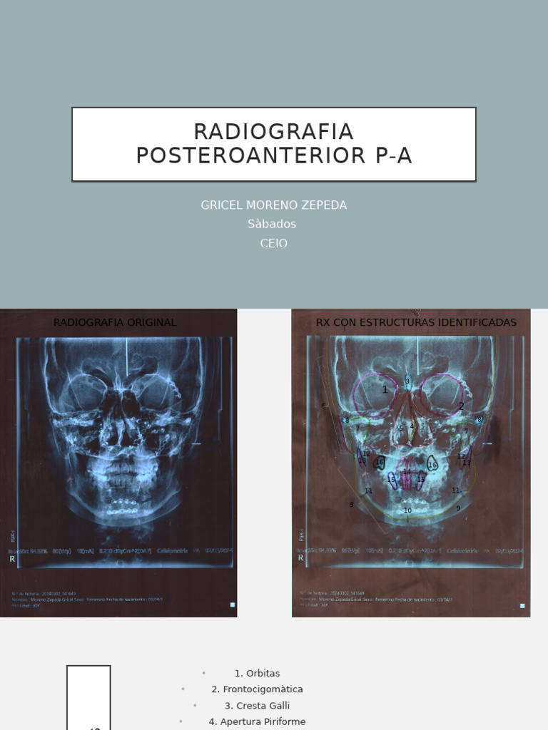 Radiografia Posteroanterior P-A | PDF