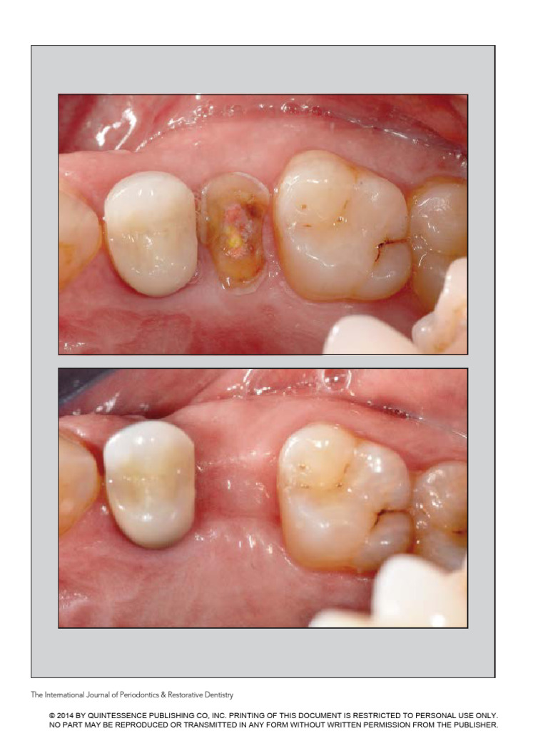 A. Cardaropoli 2014 | PDF