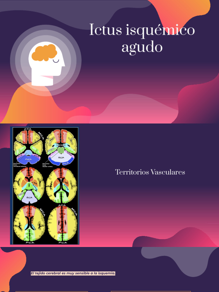 Ictus Isquémico Agudo | PDF