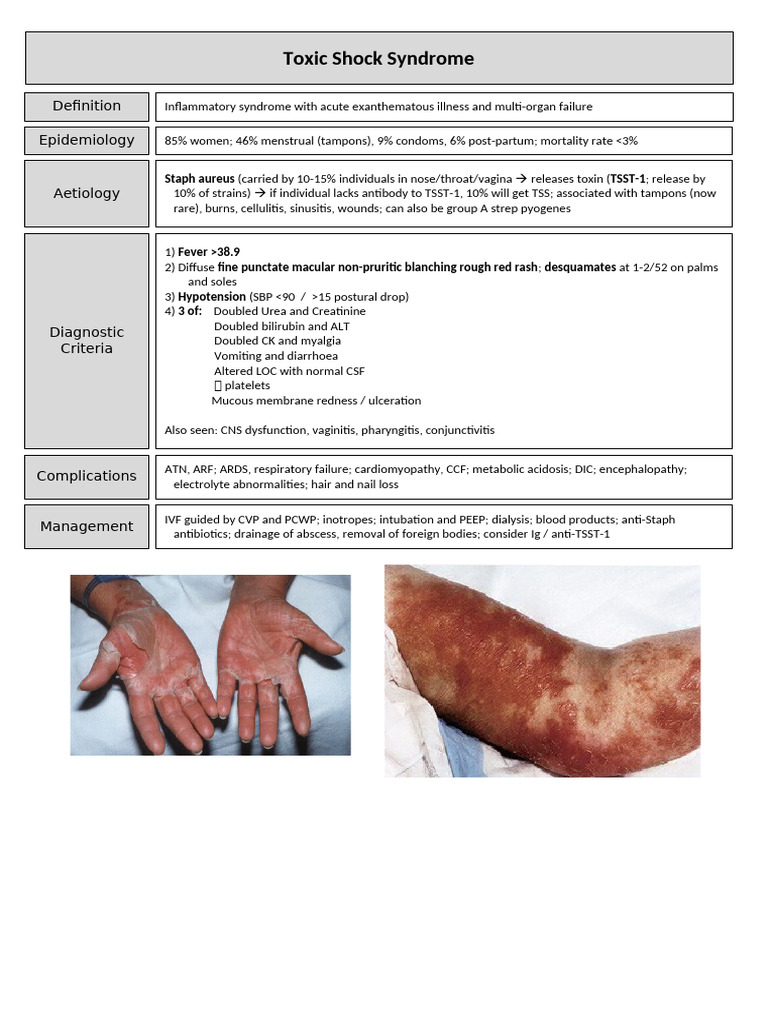 Toxic Shock Syndrome | PDF