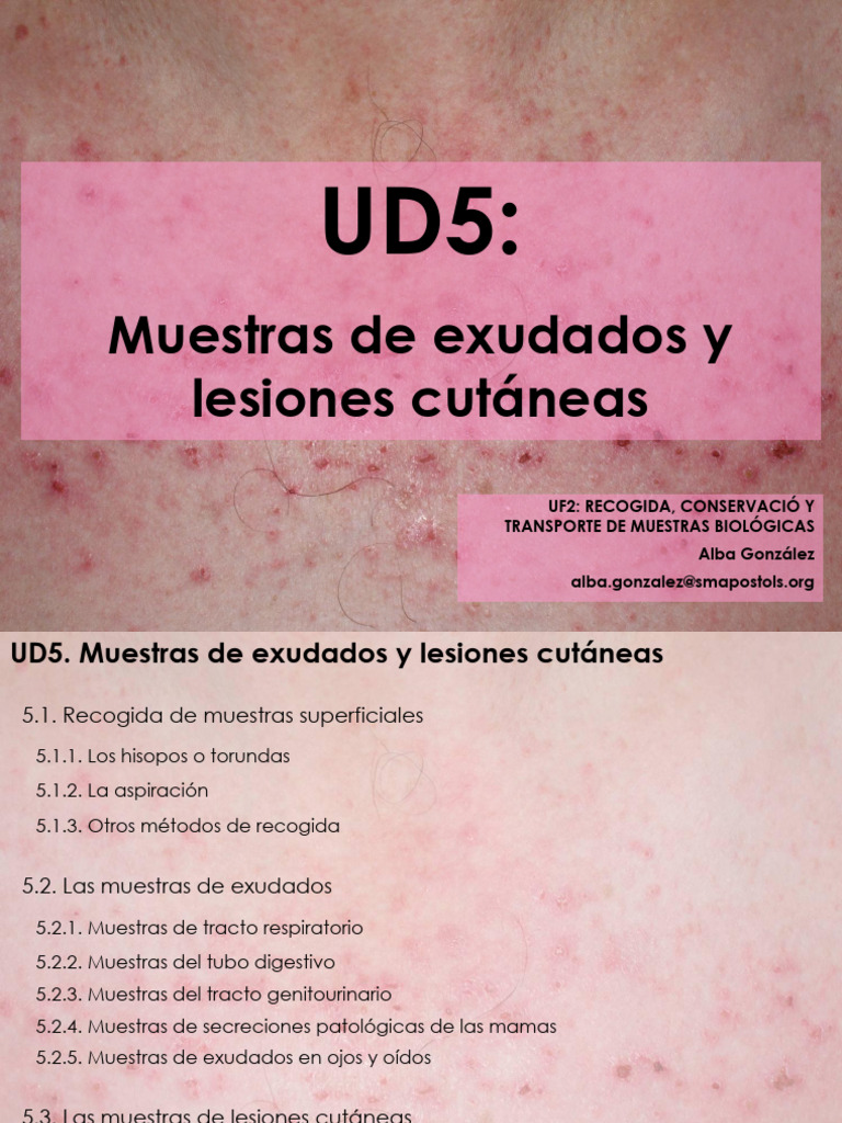 UF2. UD5. Muestras de Exudados y Lesiones Cutáneas | PDF