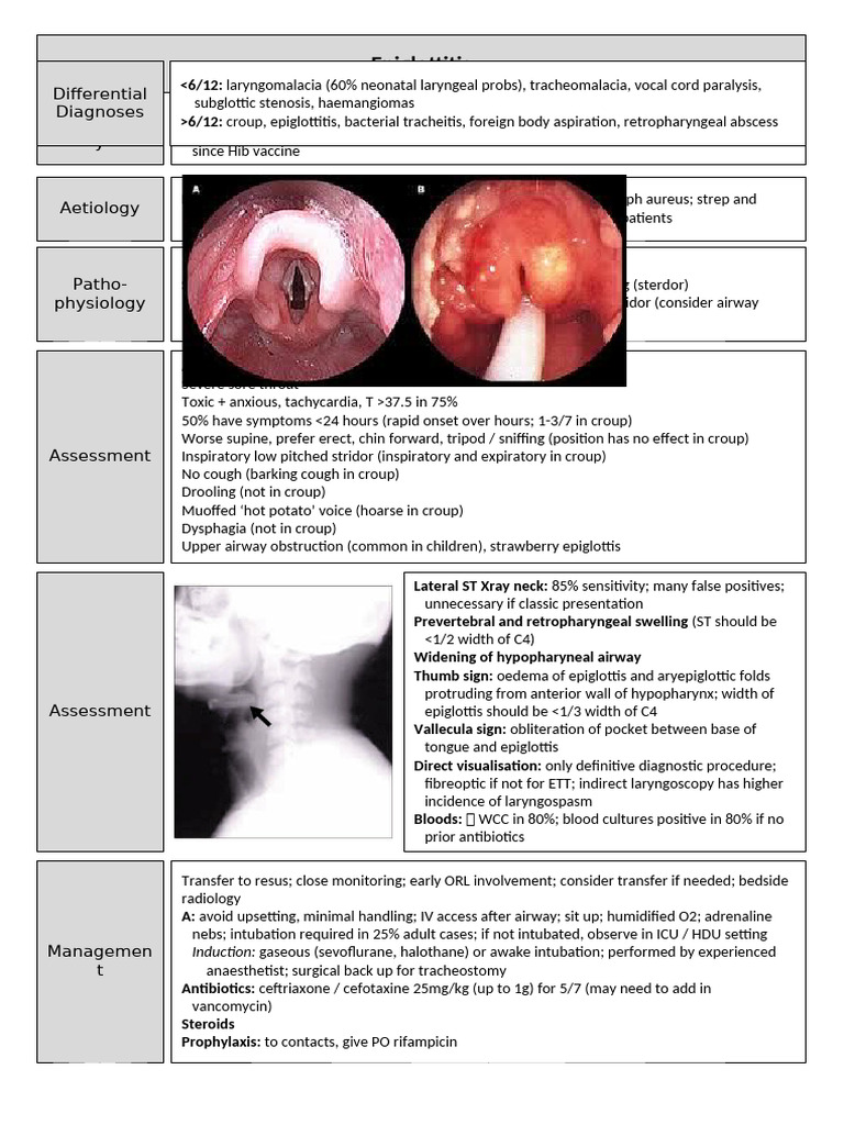 Epiglottitis | PDF