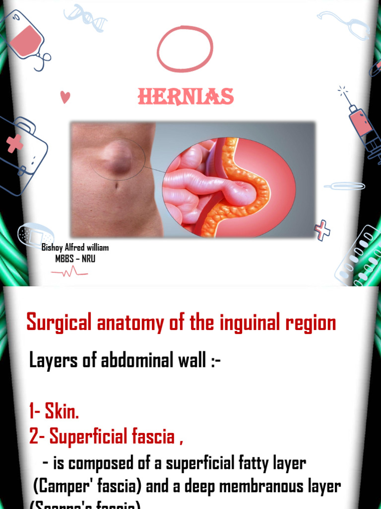 10 Hernias | PDF