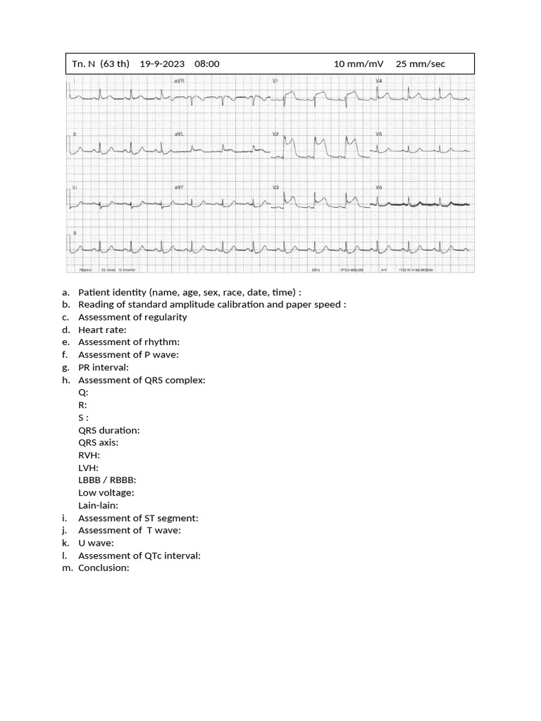 Latihan EKG Iskemia Infark | PDF