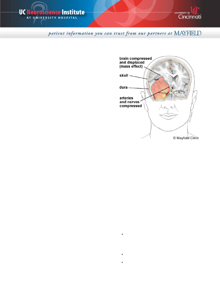 PE Brain Tumors UCNI | PDF