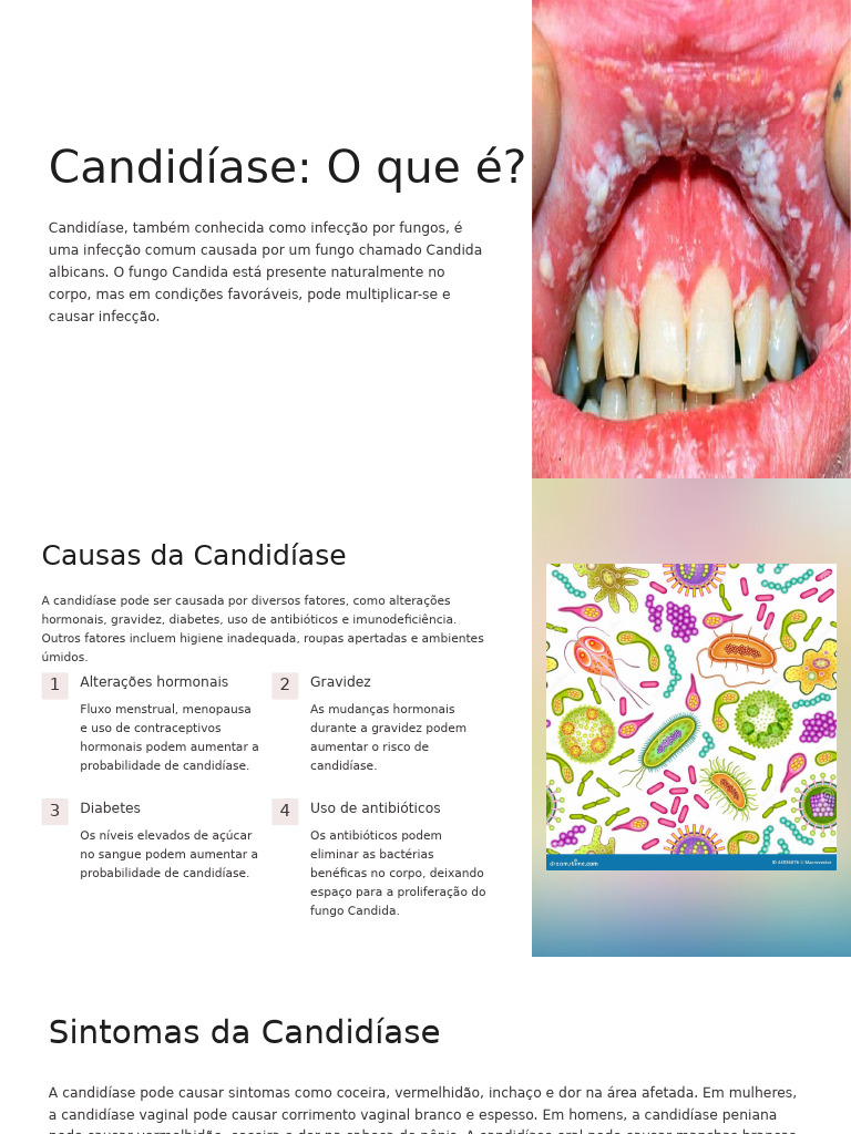 Candidiase | PDF