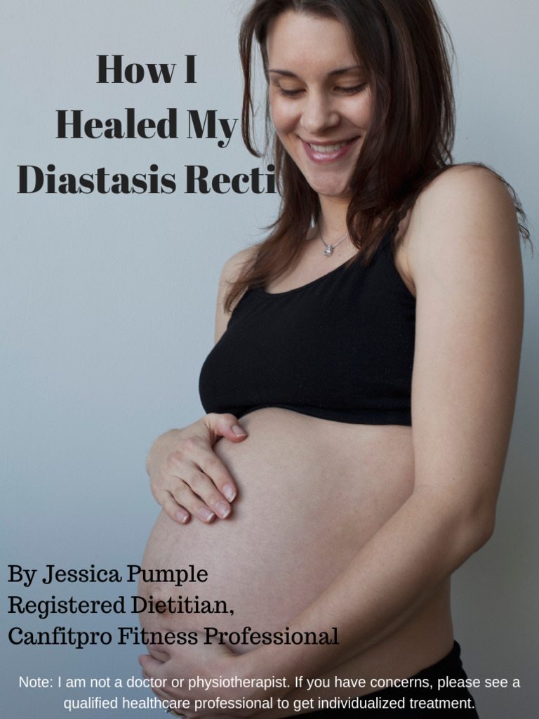 How I Healed My Diastasis Recti | PDF