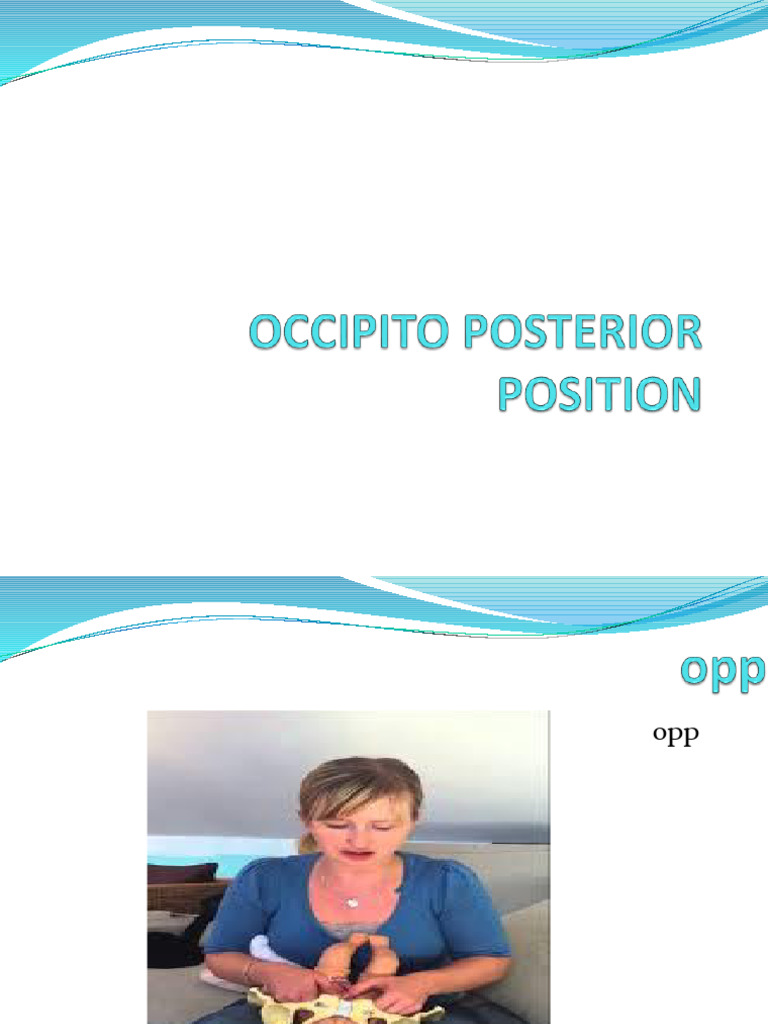 Occipito Posterior Position | PDF