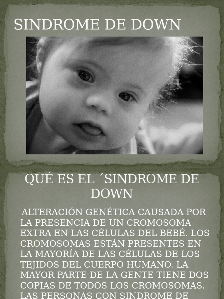 Sindrome de Down | PDF