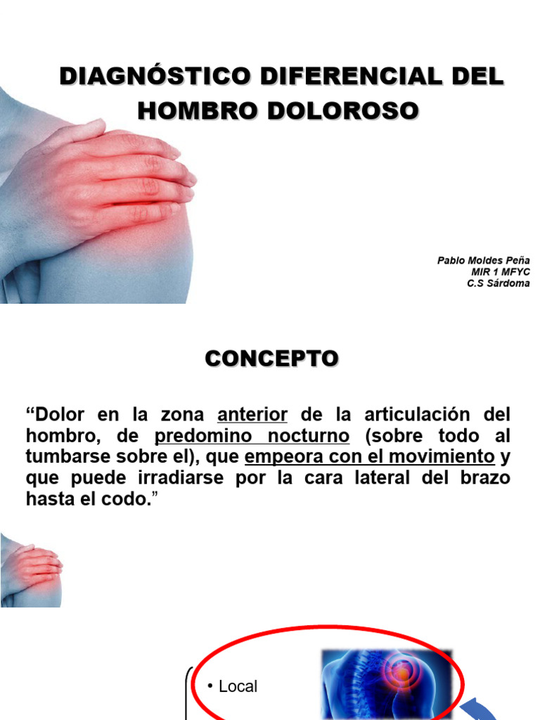 Diagnostico Diferencial Del Hombro Doloroso | PDF