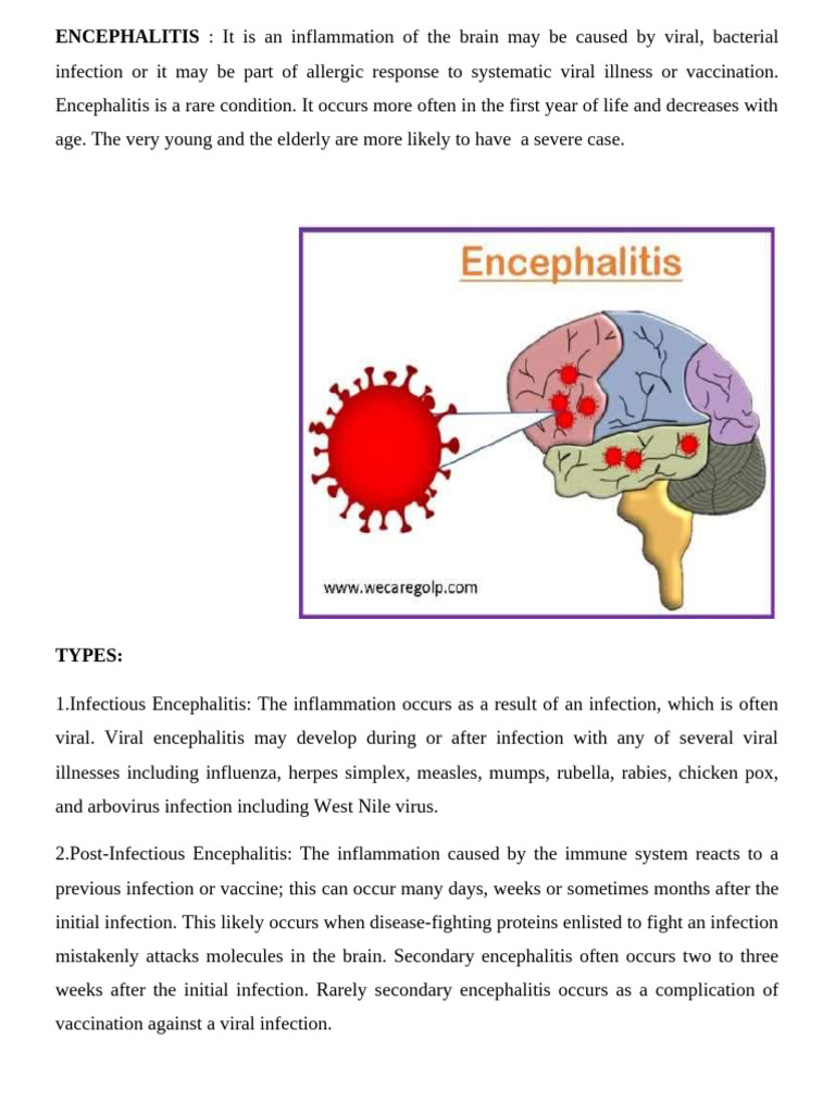ENCEPHALITIS | PDF