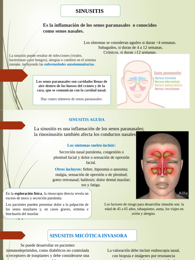 Sinusitis | PDF