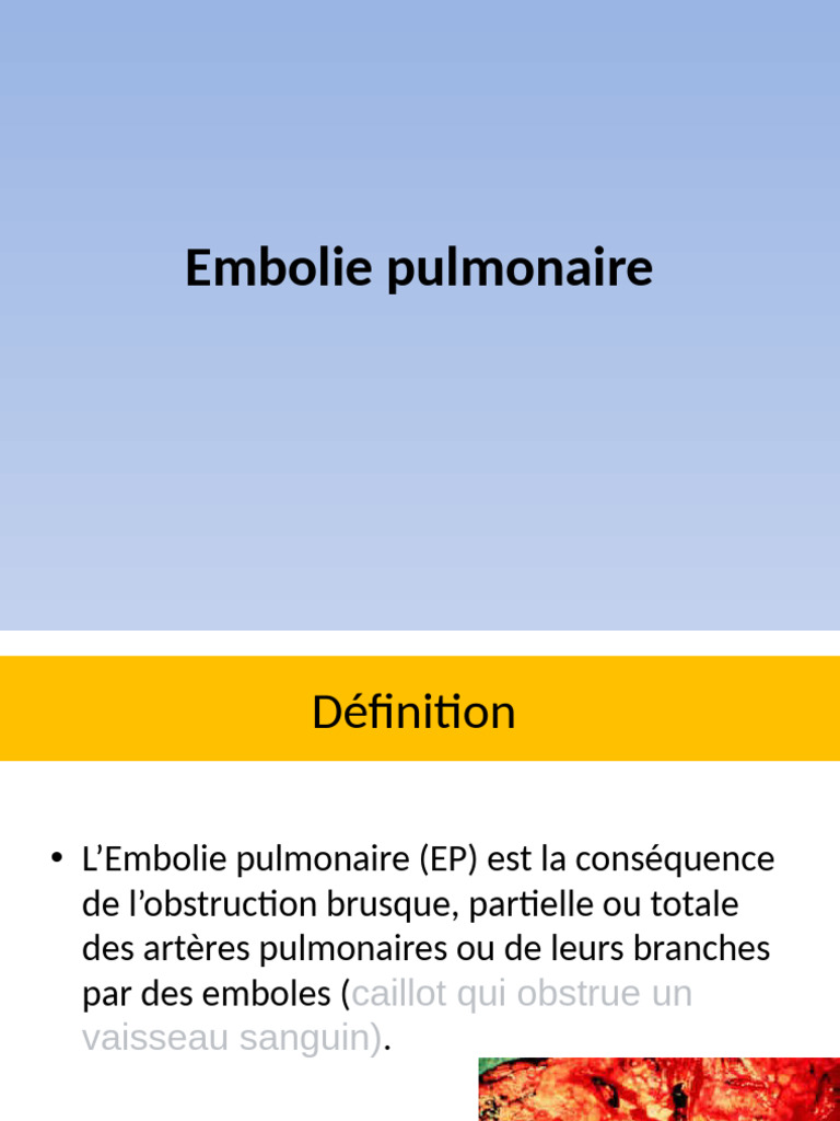 20 - Embolie Pulmonaire | PDF