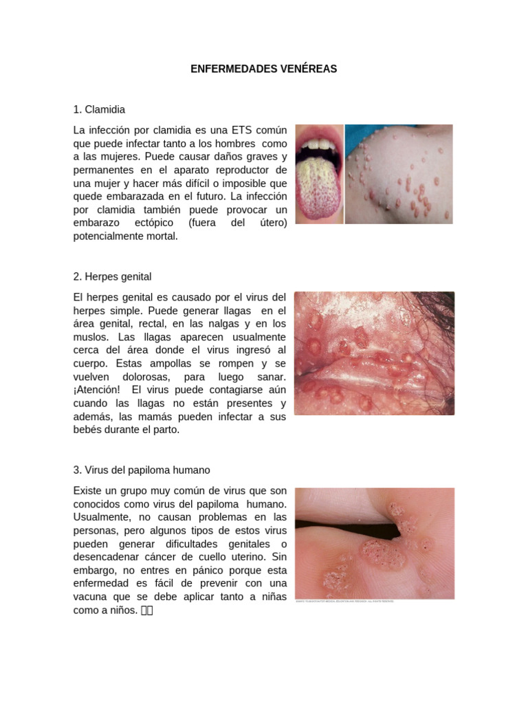 Enfermedades Venéreas | PDF