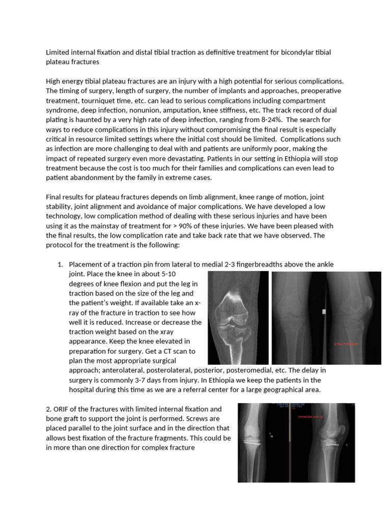 Prospective Study of High Energy Tibial Plateau Fractures (41C) With ...